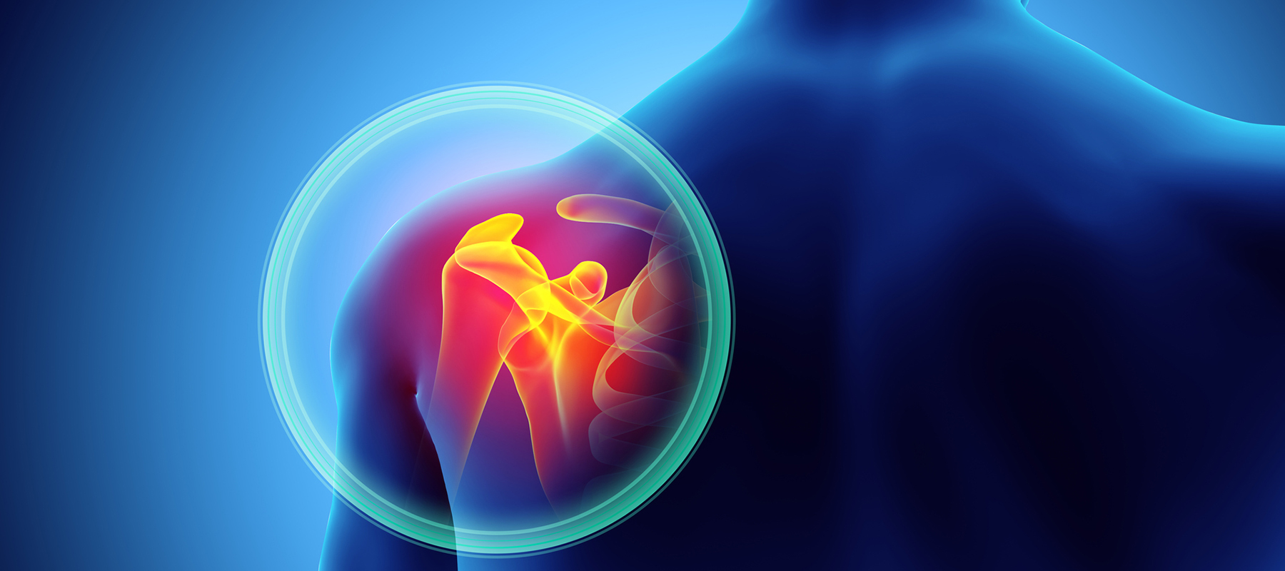 Humanitas Cellini, spalla “riparata” con il supporto della tecnologia ...