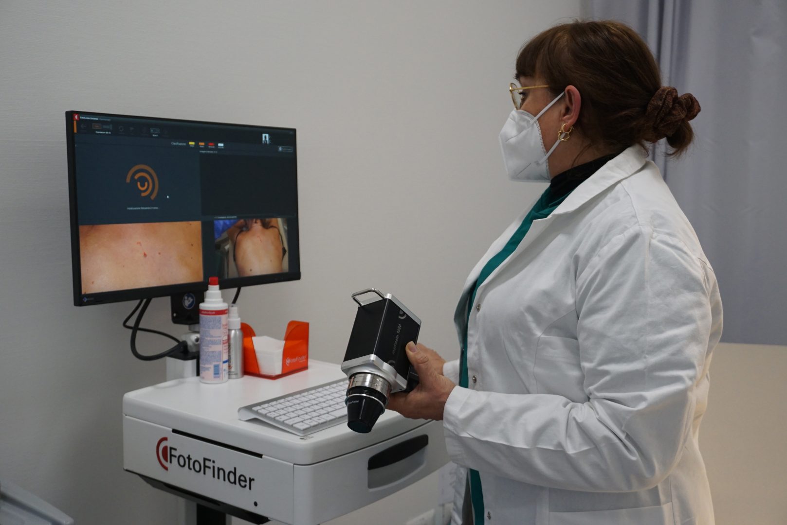 Mappatura dei nei: Fotofinder, l’ultima frontiera per la prevenzione ...